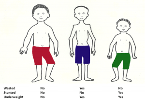 comparison_of_normal_wasted_and_stunted_child | International ...
